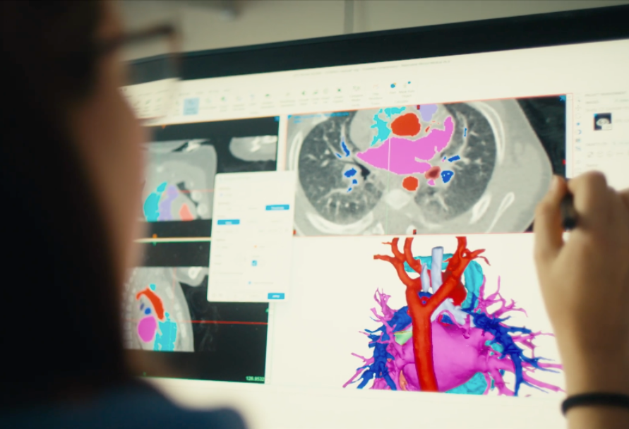 Cardiovascular 3D Modeling and Simulation Program | Boston Children's ...